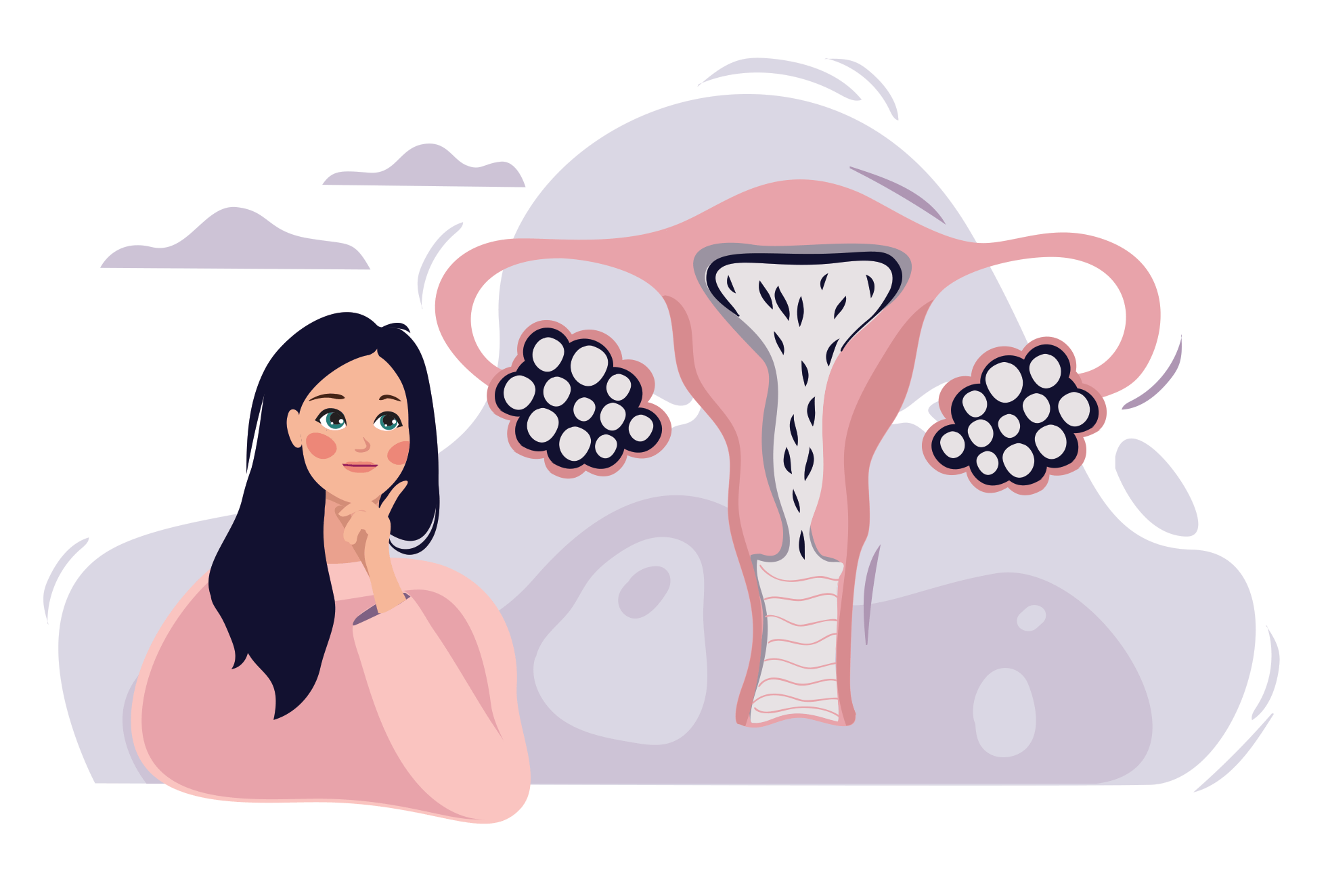 1 Quiz: Do I Have PCOS? - Meds For Less