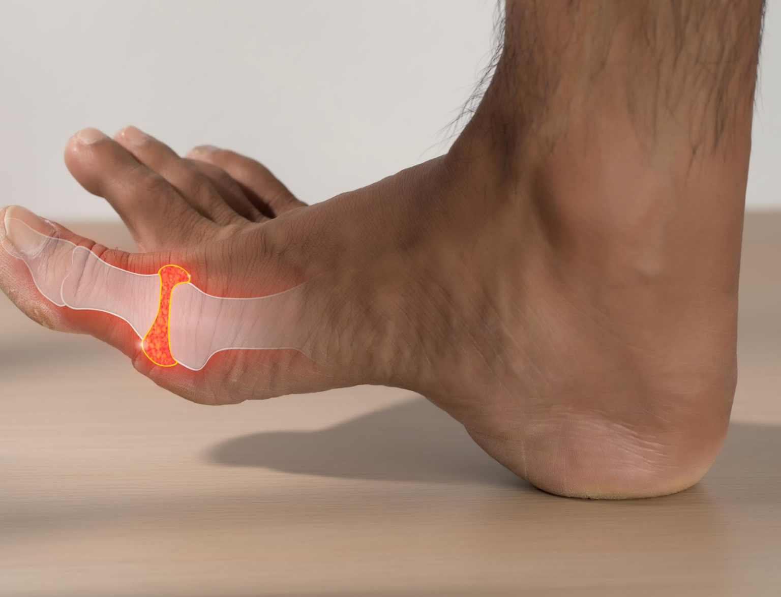 10 Minute Gout Cure: Fast Relief For Gout Symptoms | Blog Meds For Less